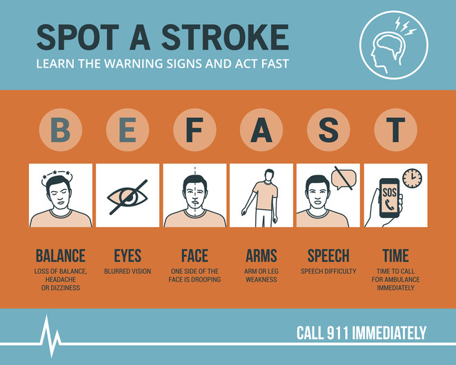 How To Recognize A Ministroke Or Stroke And What To Do Harvard Health How To Recognize A Ministroke Or Stroke And What To Do Harvard Health