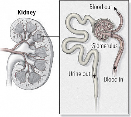 Diabetic Nephropathy - Harvard Health