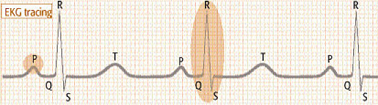 Electrocardiogram (EKG) - Harvard Health