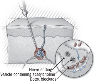 All Diseases & Conditions Articles | Page 93 - Harvard Health