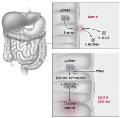 All Digestive Health Articles | Page 20 - Harvard Health