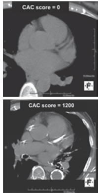 All Heart Health Articles | Page 165 - Harvard Health