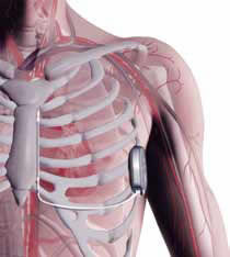 All Heart Health Articles | Page 167 - Harvard Health