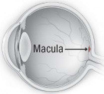 Macular Degeneration - Harvard Health